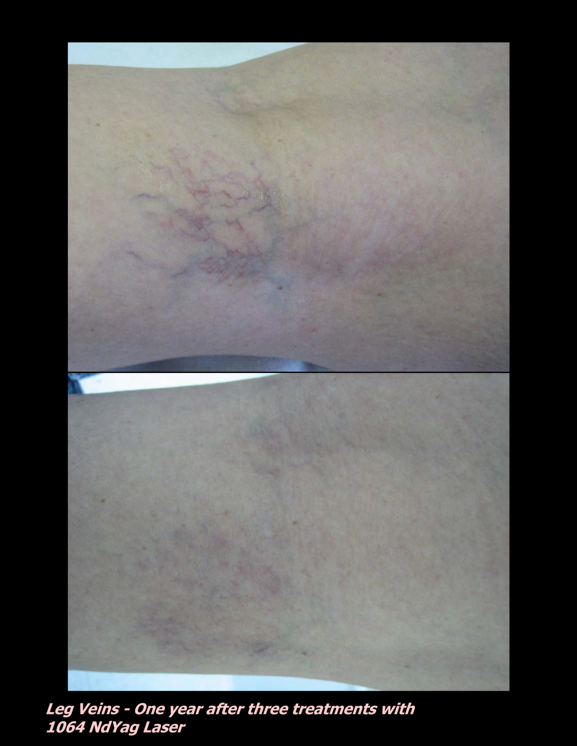 Completed0307 – Appalachian Spring Dermatology